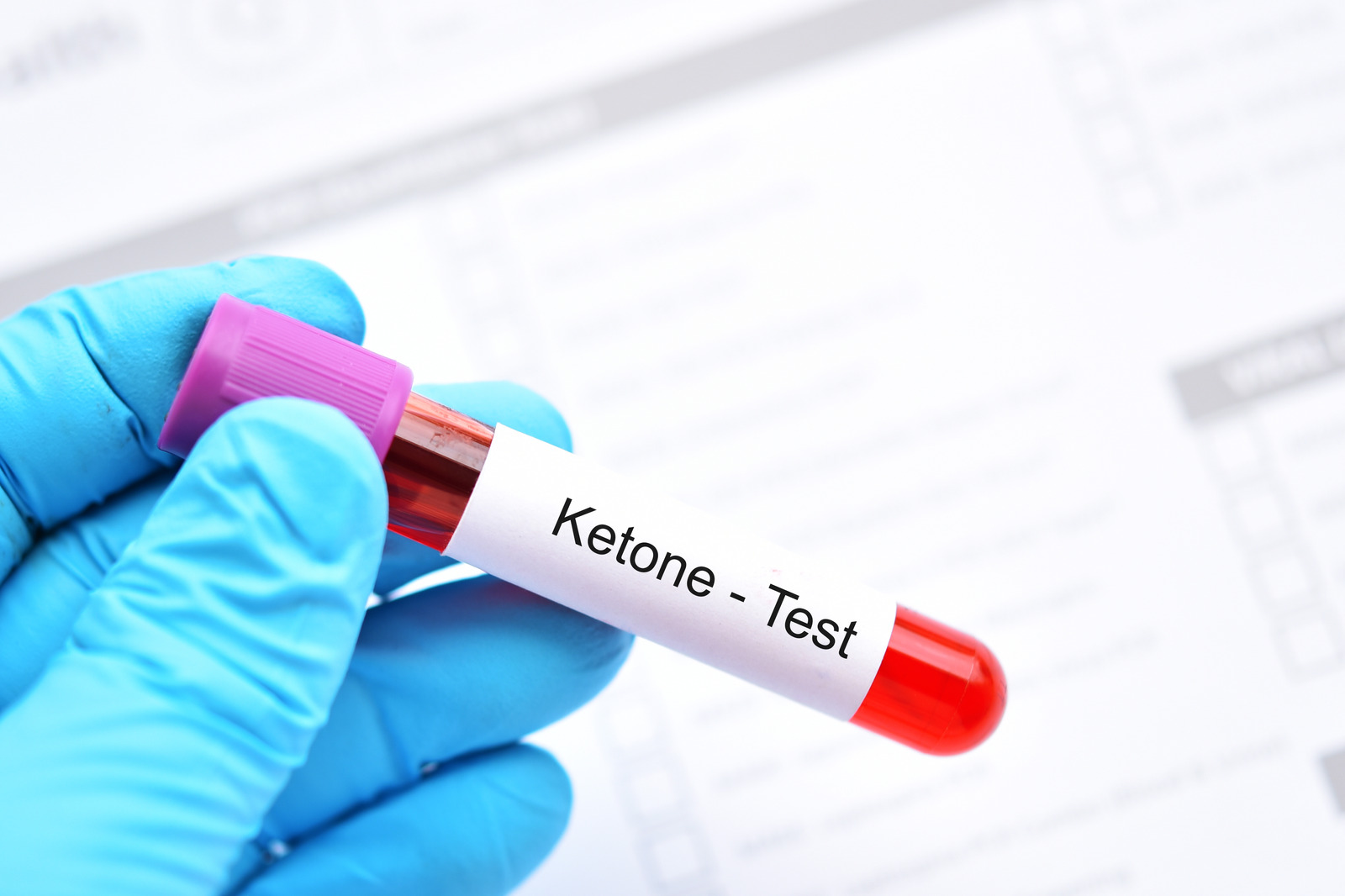 Continuous ketone monitoring for type 1 diabetes - Diabetes Research ...